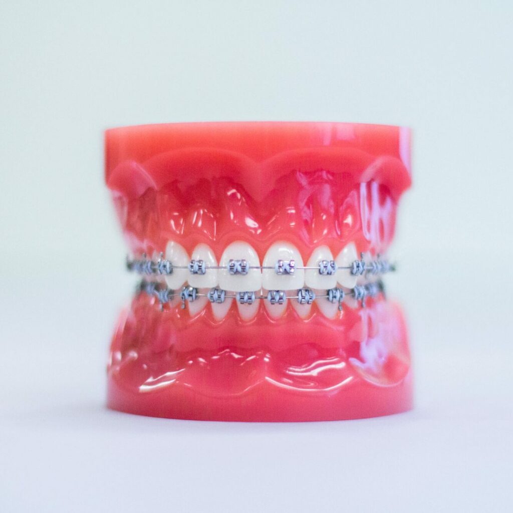 Top Rankings Of Braces Colors (By Season) - Yang Orthodontics
