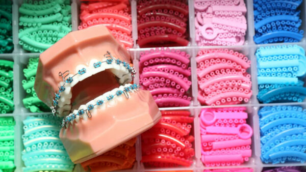 Top Rankings Of Braces Colors (By Season) - Yang Orthodontics